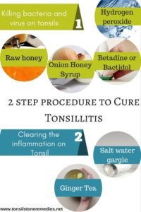 2 step procedure to Cure Tonsillitis Effectively, Naturally, And Completely