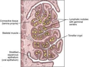 5 Ways to remove Tonsil stones even if you can’t see them